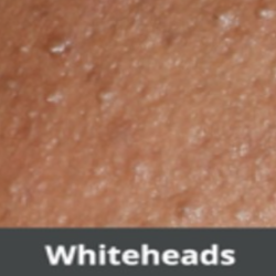 online consultation form | Zapped Skin
